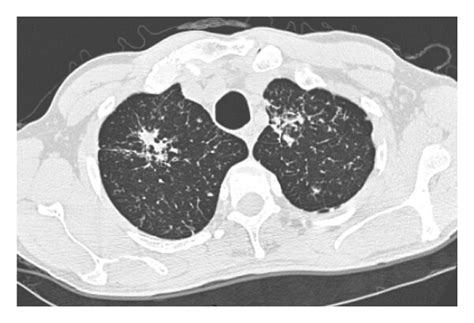 Automatic Lung Segmentation Based On Texture And Deep Features Of Hrct