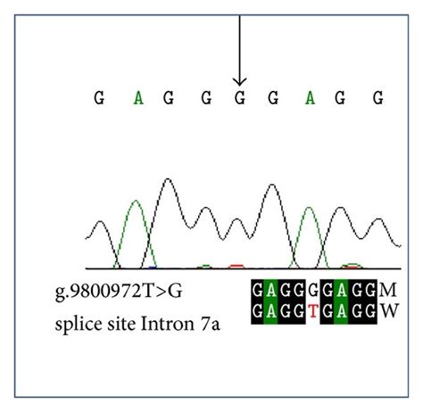 Sequencing Electropherogram Of Polymorphisms Of Ogg1 A B C