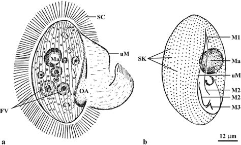 Pleuronema Crassum Live Specimen A And After Protargol Impregnation