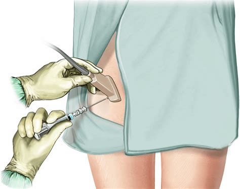 Acl Surgery For Nerve Block