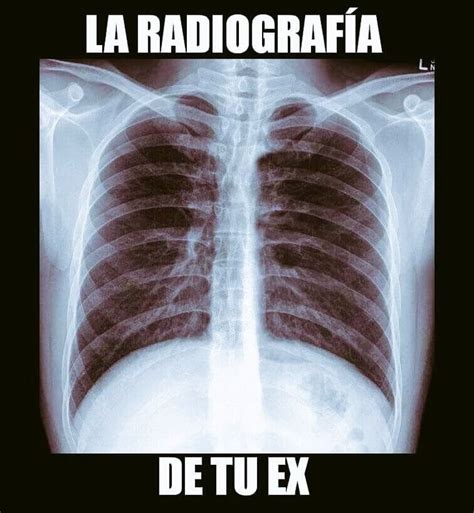 Radiografía e historia del meme qué es y para qué lo usamos Explore o universo das apostas