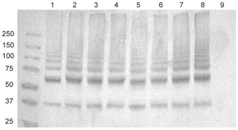 Sds Page Of Mutanolysin Extracted Surface Proteins And Western Blotting Download Scientific