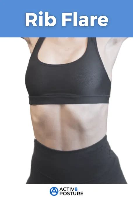 What Is Rib Flare Symptoms Causes And How To Fix It Naturally