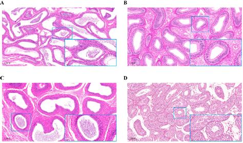 Figure 1 From Comparative Analysis Of Epididymis Cauda Of Yak Before And After Sexual Maturity