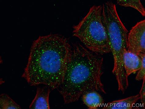 Eea1 Fusion Protein Ag28849 Proteintech