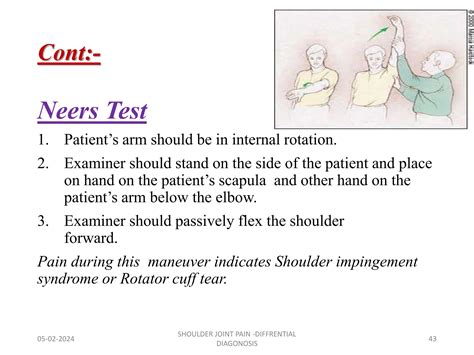 Shoulder Joint Introduction Examinationfrozen Shoulder Shoulderjoint Jointsof Thebody