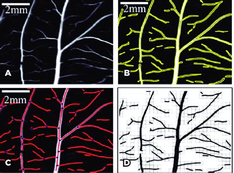 detection of vascular network architecture a a typical image