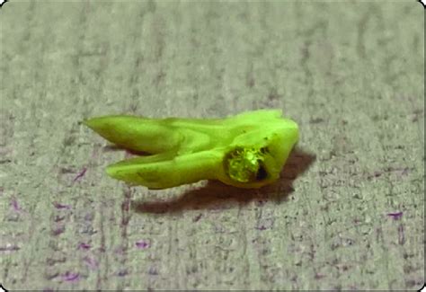 Application Of Sdf Followed By Ki Till Forming A Creamy Mix Download