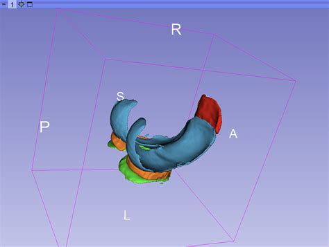 3d Visualization Method In Slicer Support 3d Slicer Community