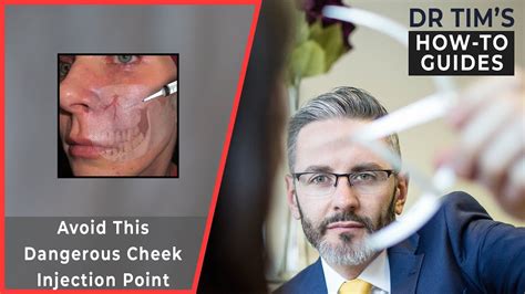 Avoid This Dangerous Cheek Injection Point Youtube