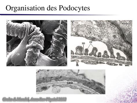 Ppt Podocytopathies Powerpoint Presentation Free Download Id3436595