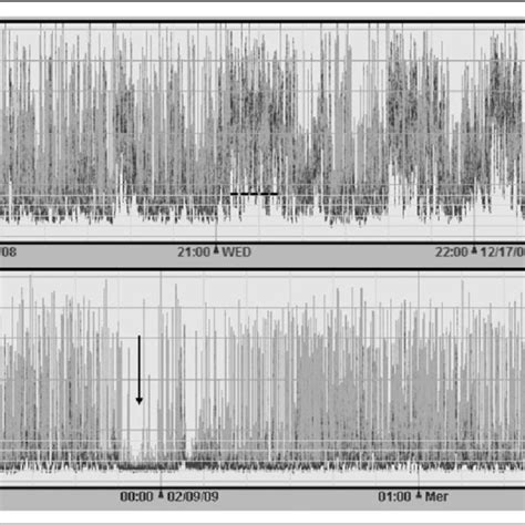 Examples Of Aeeg Recordings With Different Background Activity A Download Scientific Diagram