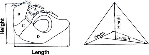 Suprameatal Triangle