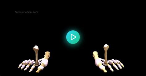 Human Skeleton Build Album On Imgur