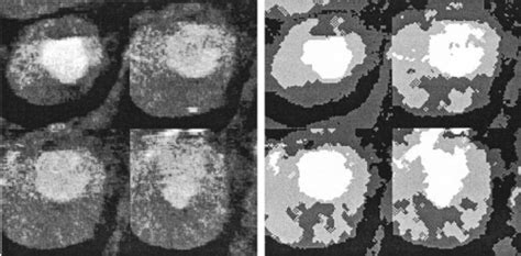 Comparison Of The Segmentation Results A Original Ct Image B K Download Scientific