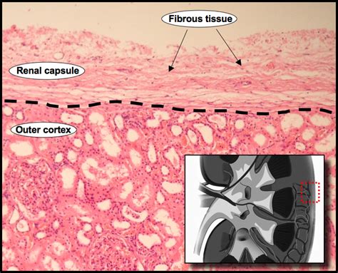 Renal Capsule Histology Renal Anatomy 3 Glomerular Histology