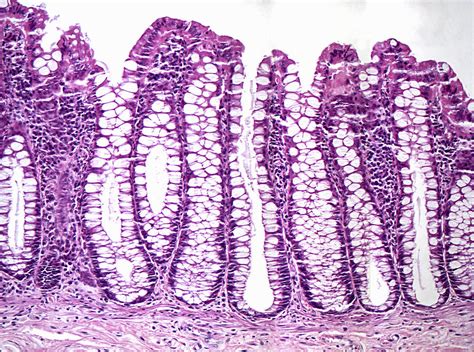 Colon Mucosa Lm Photograph By Alvin Telser