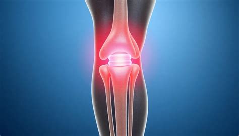 Soulager La Douleur Dun Nerf Sciatique Coincé Dans La Jambe Droite Causes Et Solutions