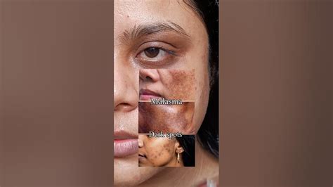 Klairs Vitamin C And Vitamin E Mask Skincare For Malasma Skincare For