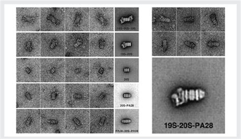 Electron Micrographs Of A Negatively Stained Proteasome Mixture Showing Download Scientific