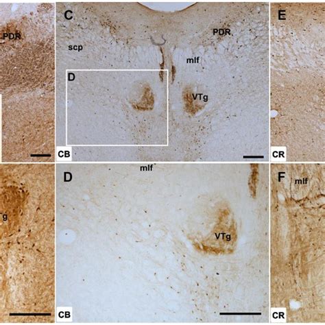 Dorsal Tegmental Nucleus Of Gudden Ac Low Magnification 50×