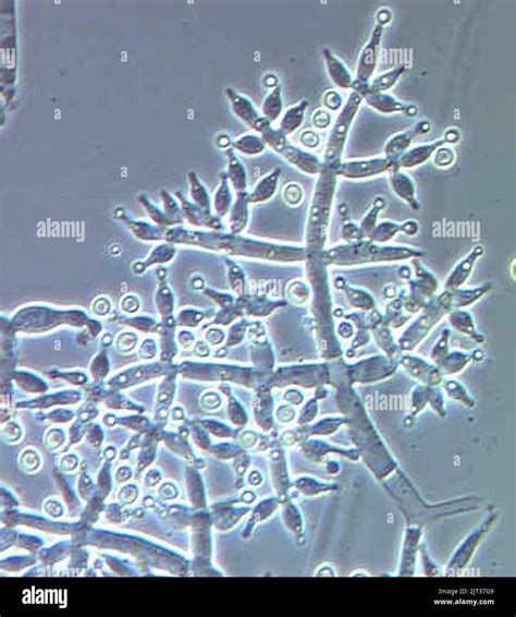 Trichoderma Harzianum Immagini E Fotografie Stock Ad Alta Risoluzione