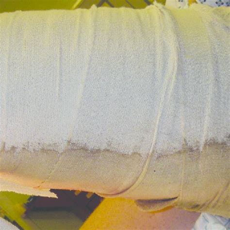 Strikethrough Seen In Conventional Dressings Download Scientific Diagram