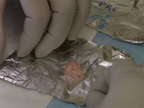 Video Mouse Adipose Tissue Collection And Processing For RNA Analysis