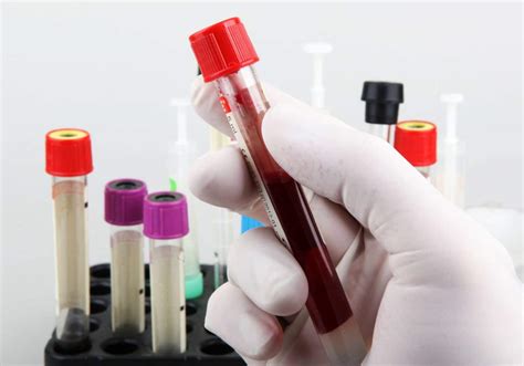 How Long Does Valium Stay In Your System