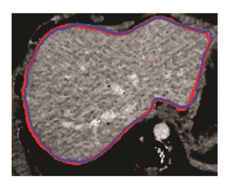 Comparisons Between Coarse Segmentation Results And Ground Truth