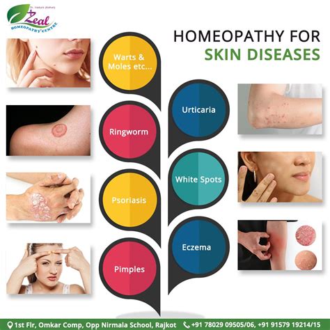 Think For Homeopathy Medicines By Dr Nirali Vaidya Kothari For Your