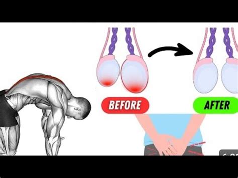 Fix Your Hanging Balls Do Everyday These Excercise Youtube