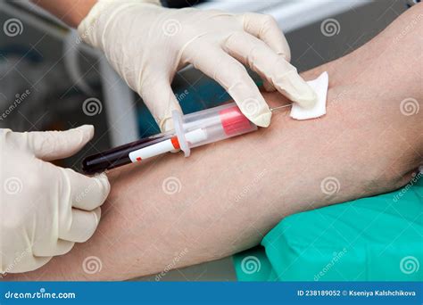 Laboratory Blood Sampling At Georgia Kirsova Blog