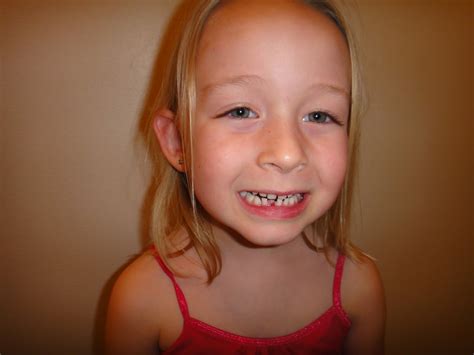 Ady Kates Story Adys Lost Her First Tooth