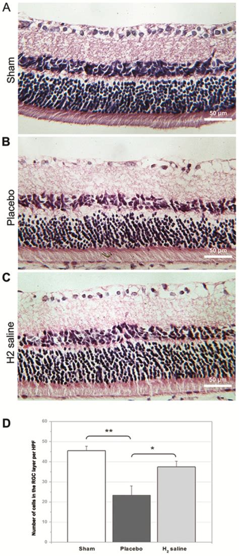 Ac Hande Staining Of Retinal Sections 2 Weeks After Onc D The