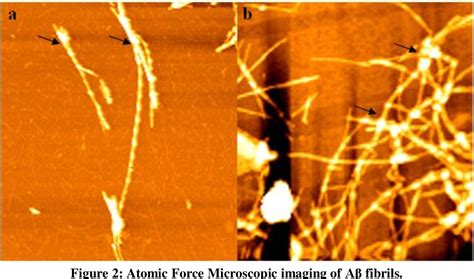 Figure 2 From The Effect Of Essential Oil Of Lavandula Angustifolia On