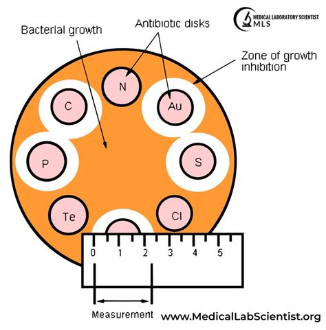 Antibiotic Sensitivity Testing Disc Diffusion Method Medical