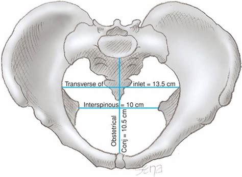 How To Tell Pelvis Size At Carmela Schatz Blog