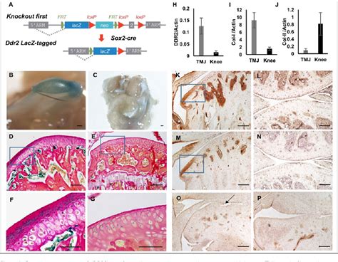 Figure 1 From Selective Role Of Discoidin Domain Receptor 2 In Murine