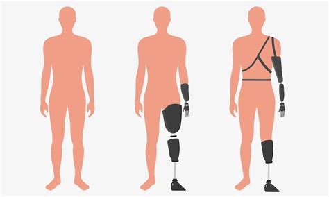 Premium Vector People Prosthesis Amputation Inclusion