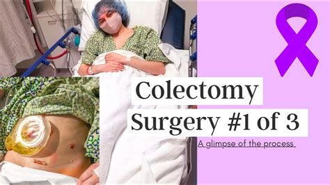 Colectomy Surgery 1 Of 3 Vlog And Waking Up From Anesthesia Youtube