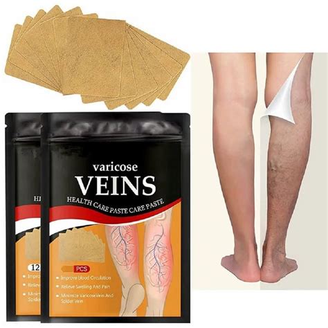 Modulyss 12pcs Varicose Veins Patch Natural Herbal Varicose Vein