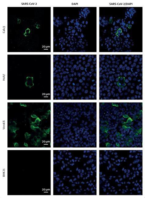 Antigen Expression Of SARS CoV 2 Antigen Expression Of SARS CoV 2 Was Download Scientific