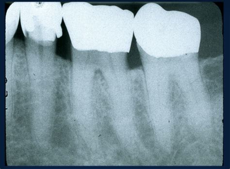 Radiology Errors Flashcards Quizlet