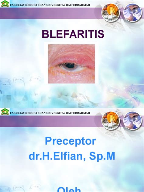 Blefaritis Pdf
