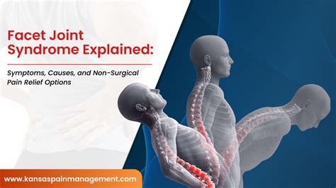 Facet Joint Syndrome Treatment Non Surgical Pain Relief