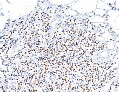 Runx3 Recombinant Rabbit Monoclonal Antibody Blr122h Invitrogen 10