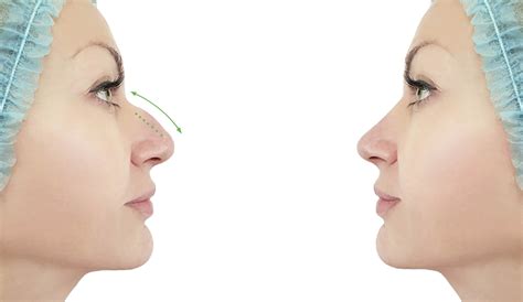 Perfect Nose Shape Front View