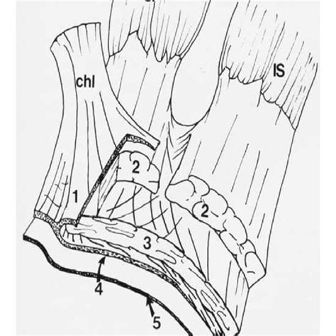 Schematic Diagram Of A Rotator Cuff Dissection Sectioned Transversely