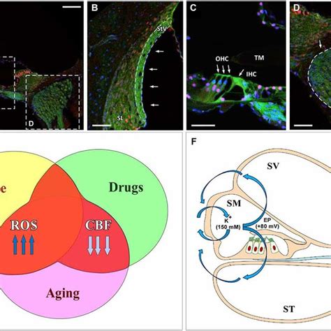 Cochlear Damage Results In Imbalances In Free Radical Formation And